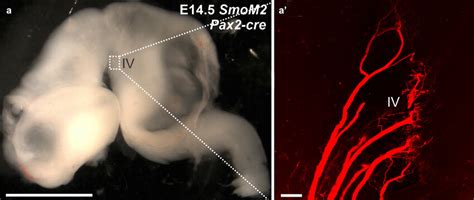 Trochlear Motoneurons Projection Ipsilateral In Mutants This Image