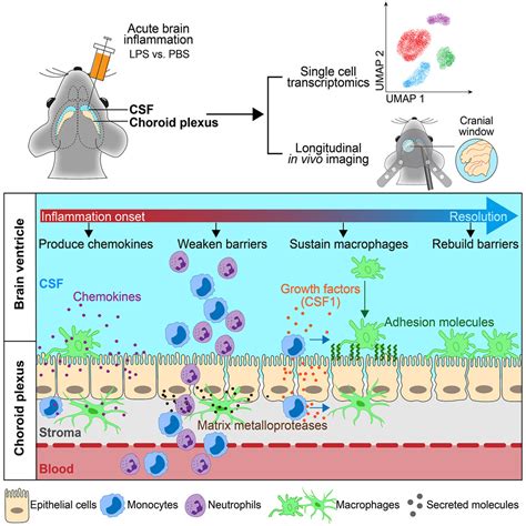 The Choroid Plexus Synergizes With Immune Cells During