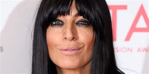 Claudia Winklemans Strictly Mini Dress Is From The High Street