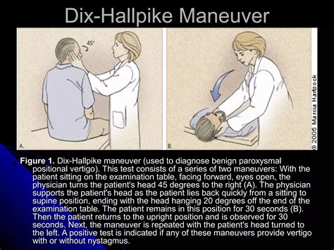 Vertigo And Dizziness Ppt