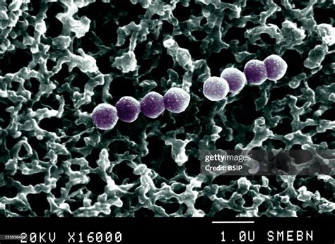 Pneumococcus Or Streptococcus Pneumoniae Is A Common Host Found In
