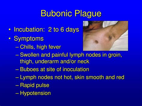 Ppt Bioterrorism Agents Plague Lesson 3 Powerpoint Presentation