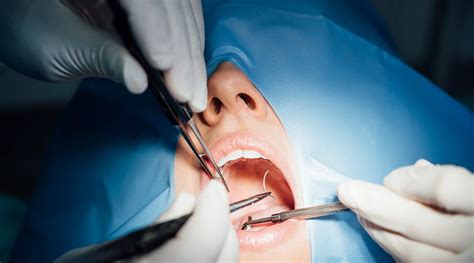 Oral And Maxillofacial Surgery Turkey Procedures Benefit Recovery