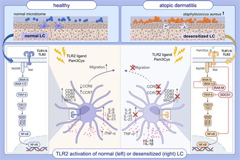 Langerhans Cell Modulation In Atopic Dermatitis Is Tlr2 Socs1‐dependent