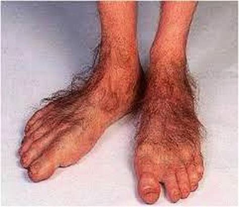 A Cure For Frodo Feet Disgustingly Delightful Scholl Express Pedi Beautie