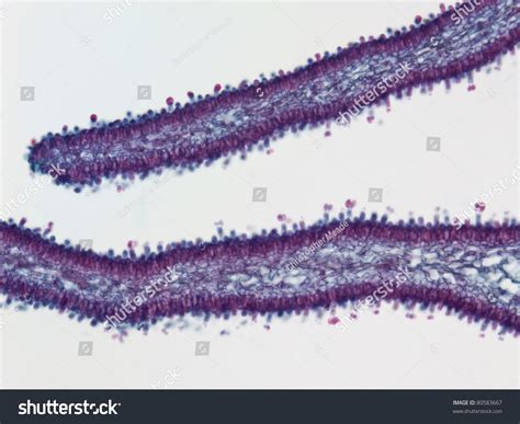 Coprinus Microscope Labeled