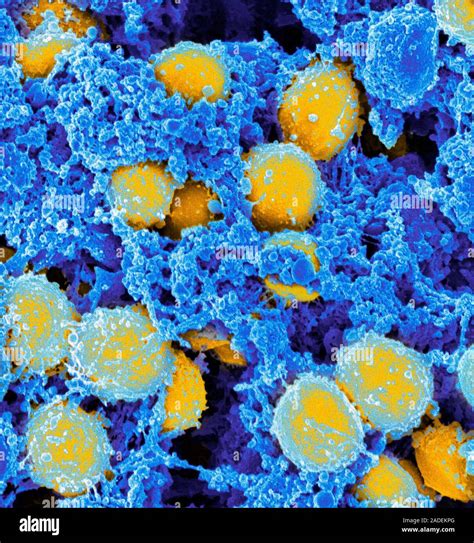 Staphylococcus Aureus Bacteria Coloured Scanning Electron Micrograph Sem Of Staphylococcus