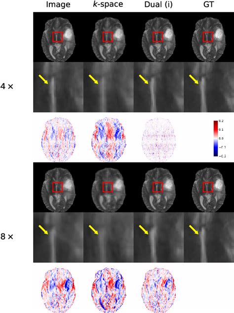 Figure 4 From Dual Domain Multi Contrast Mri Reconstruction With Synthesis Based Fusion Network