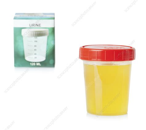 Urine Sample Stock Image F044 0672 Science Photo Library