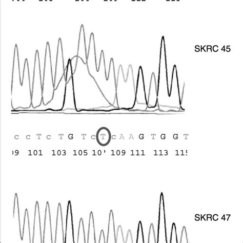 A Rt Pcr Analysis Of Hai 2 Spint2 Expression Hai 2 Spint2 Expression Download Scientific