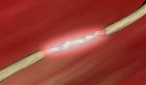 Managing Erectile Dysfunction