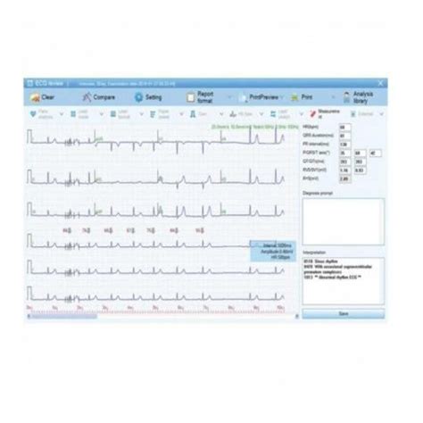 Ecg Management Software Biocare Standard Lan Port V20 Medica100