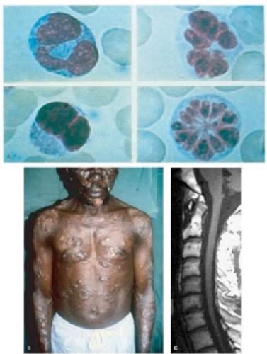 Hiv And Retroviruses Flashcards Quizlet