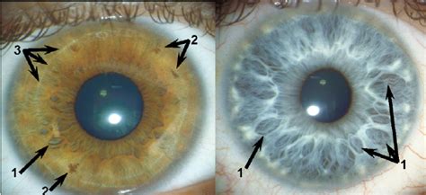 The Numbered Arrows Point Toward The Iris Characteristics Of Interest Download Scientific