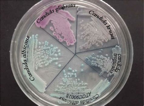 Differentiation Of Various Species Of Candida On Chrom Agar Download Scientific Diagram