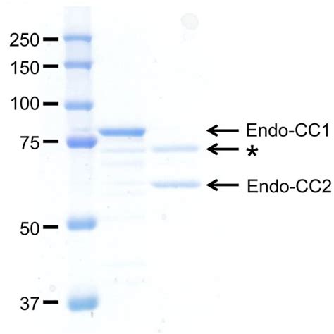 Sequence Alignment Of Endo Ccs And Endo M A Phylogenetic Tree Of Download Scientific Diagram
