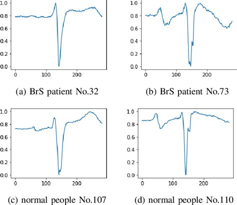 Figure 1 From Invariant Feature Extraction For Cnn Classifier By Using Gradient Reversal Layer