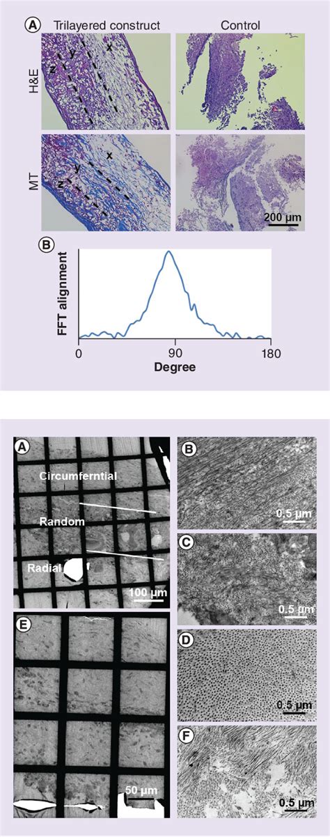 Figure 5 From In Vivo Tissue Engineering Of A Trilayered Leaflet Shaped