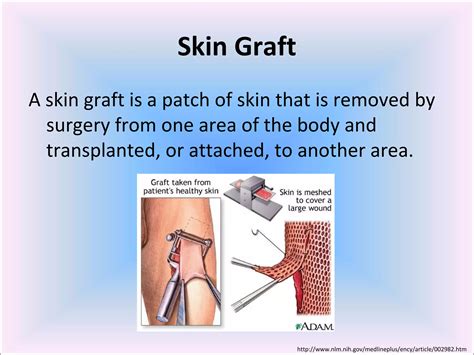 Skin Graft Ppt
