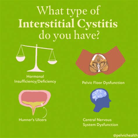 Interstitial Cystitis Pt Solutions In Lexington Ma Phrc