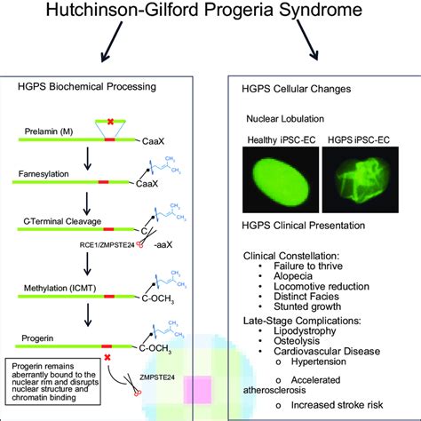 Left Depicts The Biochemical Pathway Resulting In Progerin