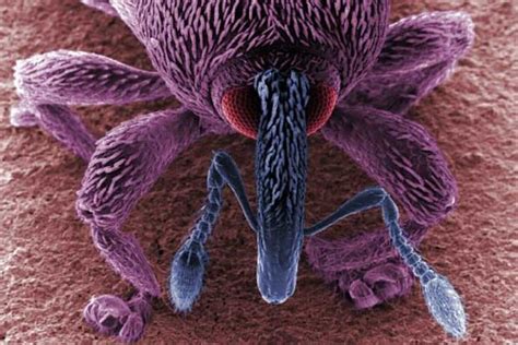 Insects Under A Microscope 32 Pics