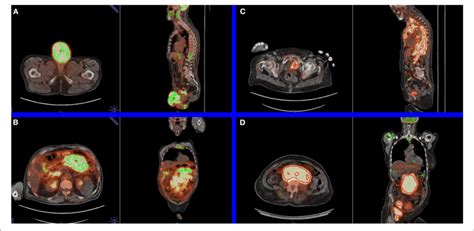 Examples In Axial And Sagittal Views Of Limitations Of The Automatic Download Scientific