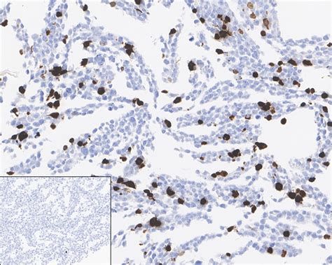 Cre Recombinase Recombinant Rabbit Monoclonal Antibody Psh01 93 Ha7 Huabio