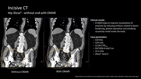 Incisive Ct купить в Украине Лучшая цена на Кt Philips Incisive Ct