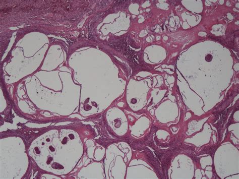 Echinococcus Infections In Dogs Prevalence Symptoms And Diagnosis