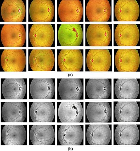 Output Enhanced Image A RGB Scale Image And B Greyscale Image Download Scientific Diagram