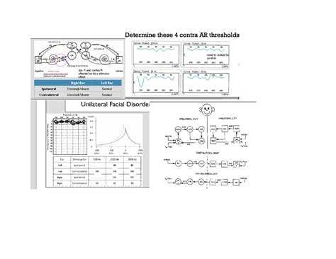 Acoustic Reflex Thresholds Analysis For Audiology Course Code Aud 101