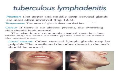 Neck Mass Approach Pptx