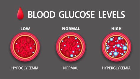 Hyperglycemia Vs Hypoglycemia Medtronic