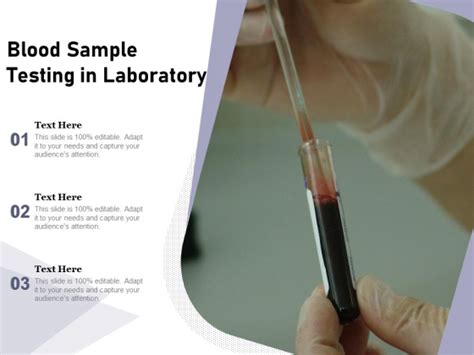 Blood Sample Testing In Laboratory Ppt PowerPoint Presentation Show Information PDF PowerPoint