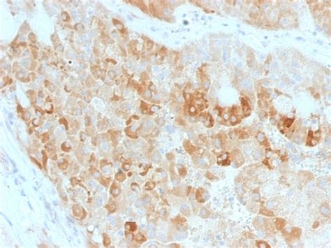 Ror2 Monoclonal Antibody Ror2 1911 4920 Msm1 P1abx