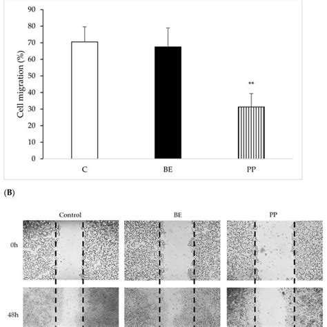 Ht29 Cell Migration After Exposure To 100 µg·ml −1 Of The Protein Download Scientific Diagram