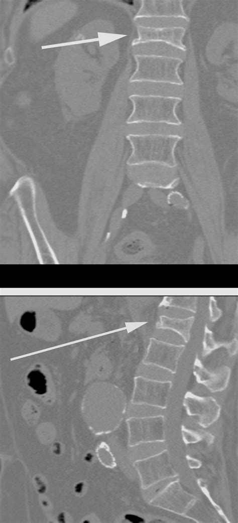 Gastrointestinal Learning Modules Ct Scanning