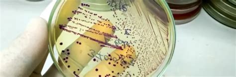 Essential Water Testing Total Coliform And E Coli Pits Environmental