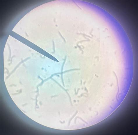 Solved can you please help me figure out this bacteria? I | Chegg.com