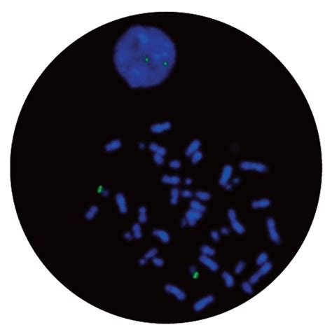 Cytocell P53 Tp53 Green Fish Probe Hematology