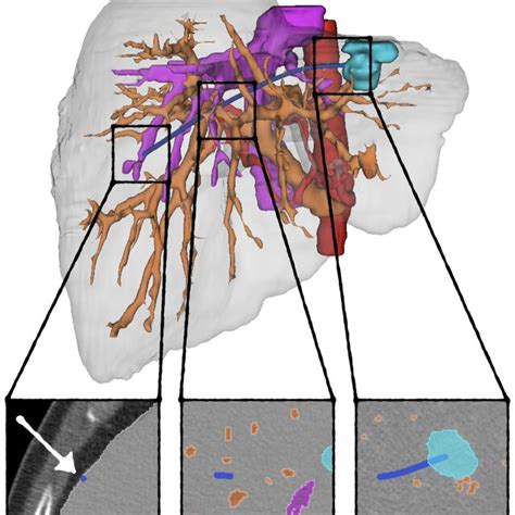 A Liver Environment From The Dataset Showing The Segmented Hepatic Download Scientific Diagram