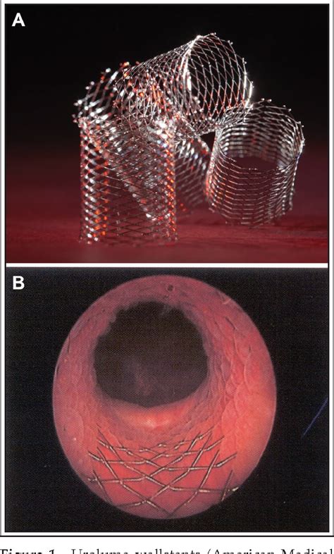Figure 1 From The Management Of Prostatic Obstruction With Urethral
