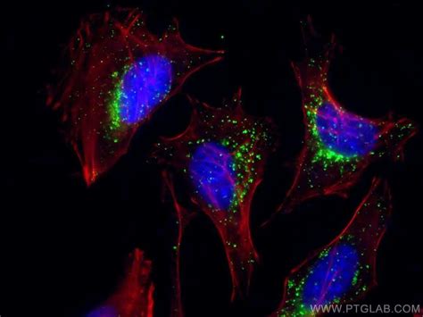 免疫荧光（if）常用细胞器标记物指南！ 知乎