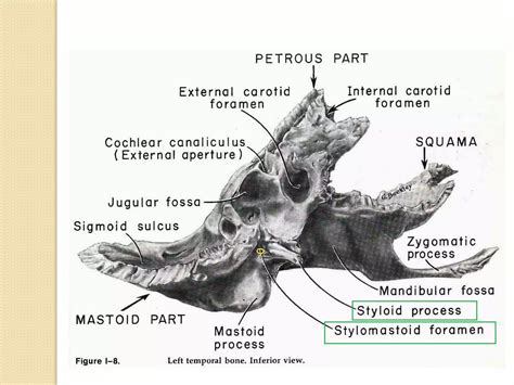 Anatomy Of Temporal Bone By Drvijay Kumar Amu Pptx