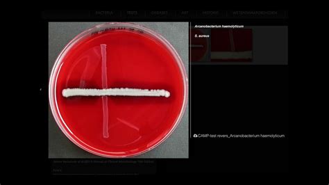 Reverse Camp Test Arcanobacterium Haemolyticum Microbiology Youtube