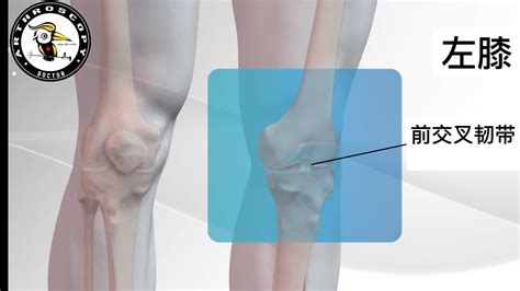 它山之石丨前十字韧带全内重建技术中国专家共识2023年版 知乎