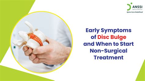 Disc Bulge Treatment Without Surgery