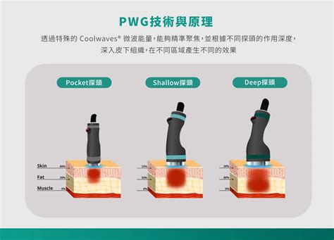 Onda Pro超微波 台大皮膚專科領軍｜璞之妍診所