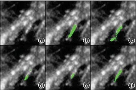 Improving Catheter Segmentation And Localization In 3d Cardiac Ultrasound Using Direction Fused Fcn